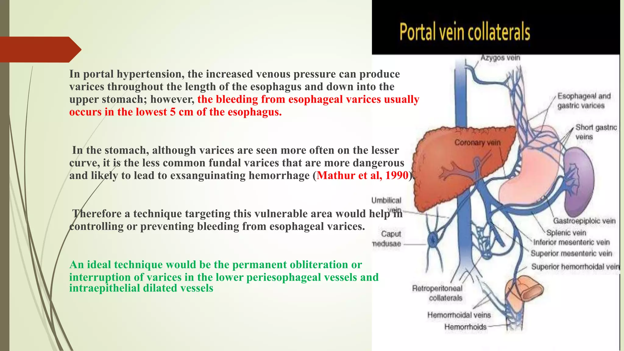 Devascularization in portal hypertension.dr quiyum | PPTX