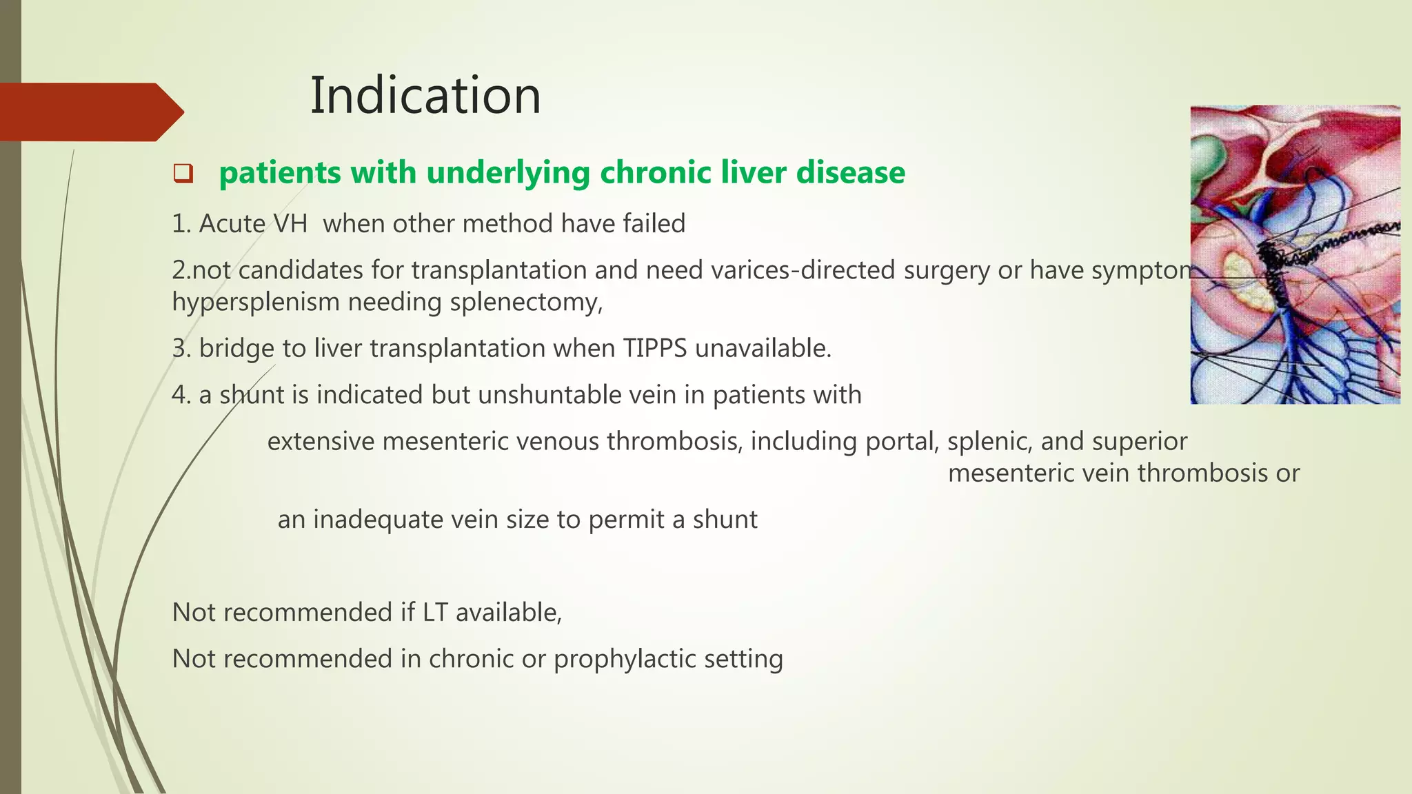 Devascularization in portal hypertension.dr quiyum | PPTX