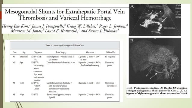 Devascularization in portal hypertension.dr quiyum | PPTX | Digestive ...