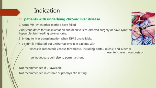 Devascularization in portal hypertension.dr quiyum | PPTX | Digestive ...