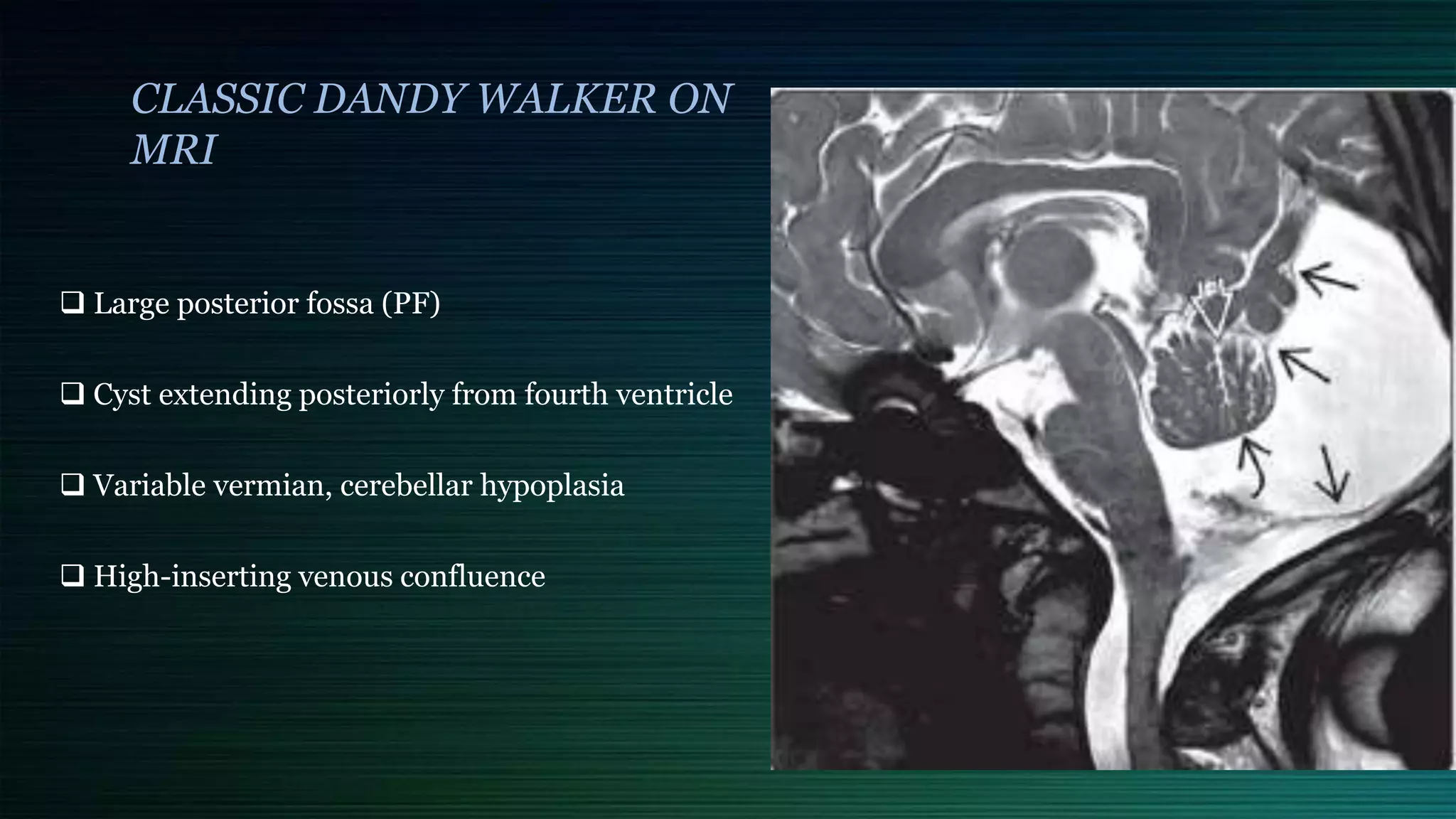 congenital brain anomalies | PPTX