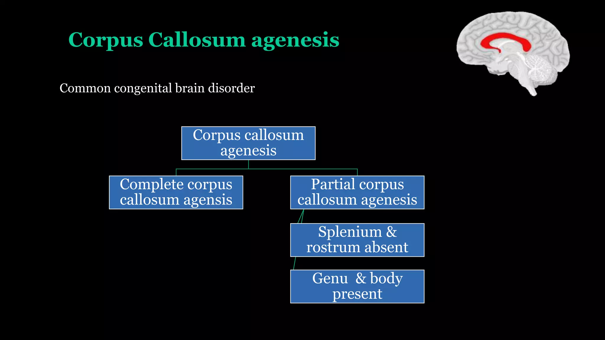 congenital brain anomalies | PPTX