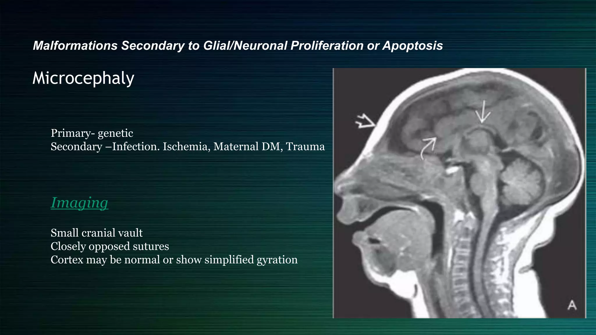 congenital brain anomalies | PPTX