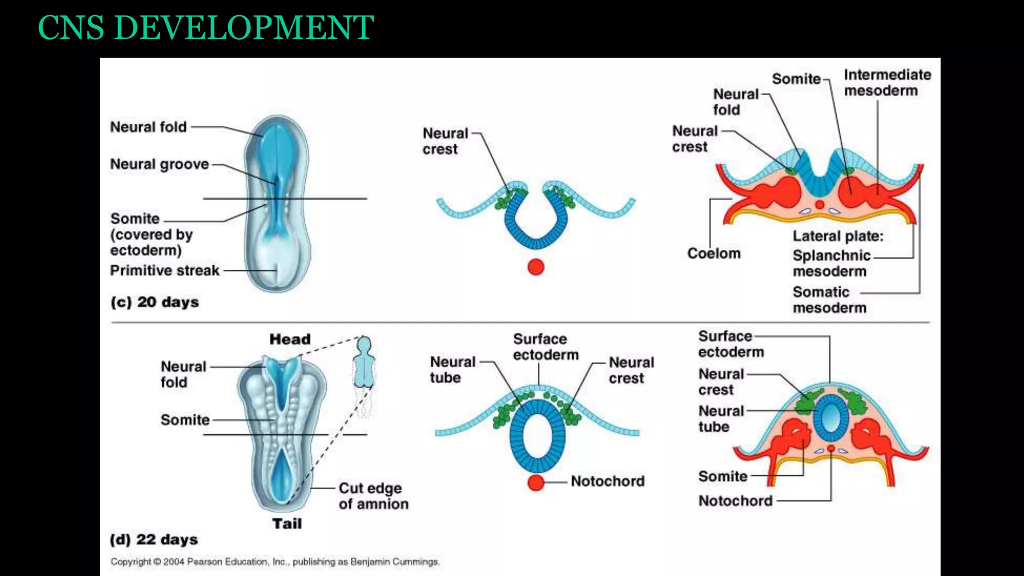 congenital brain anomalies | PPTX