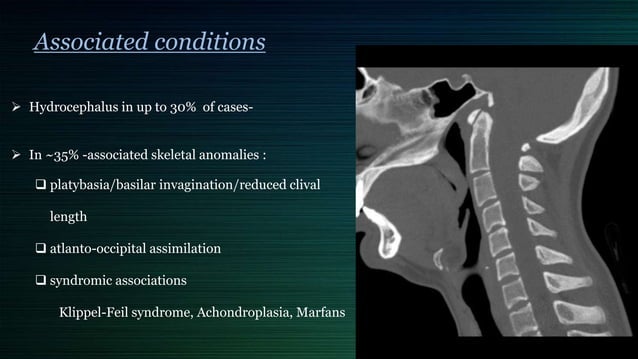 congenital brain anomalies | PPTX | Brain and Nervous System Disorders ...