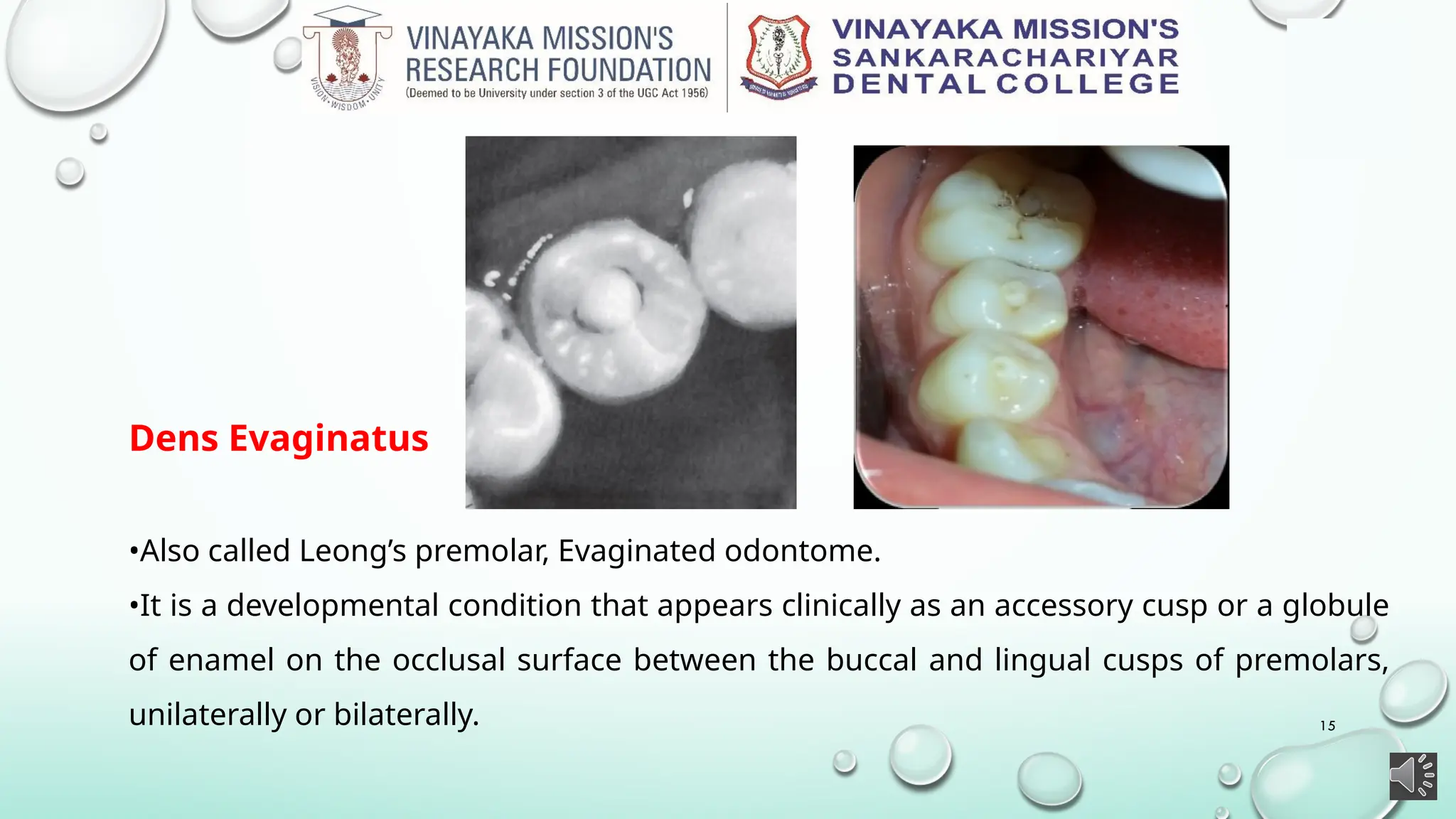 Developmental disturbances of shape of teeth.pptx