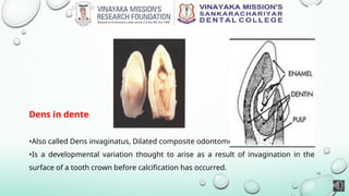 Developmental disturbances of shape of teeth.pptx
