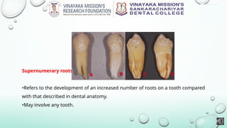 Developmental disturbances of shape of teeth.pptx