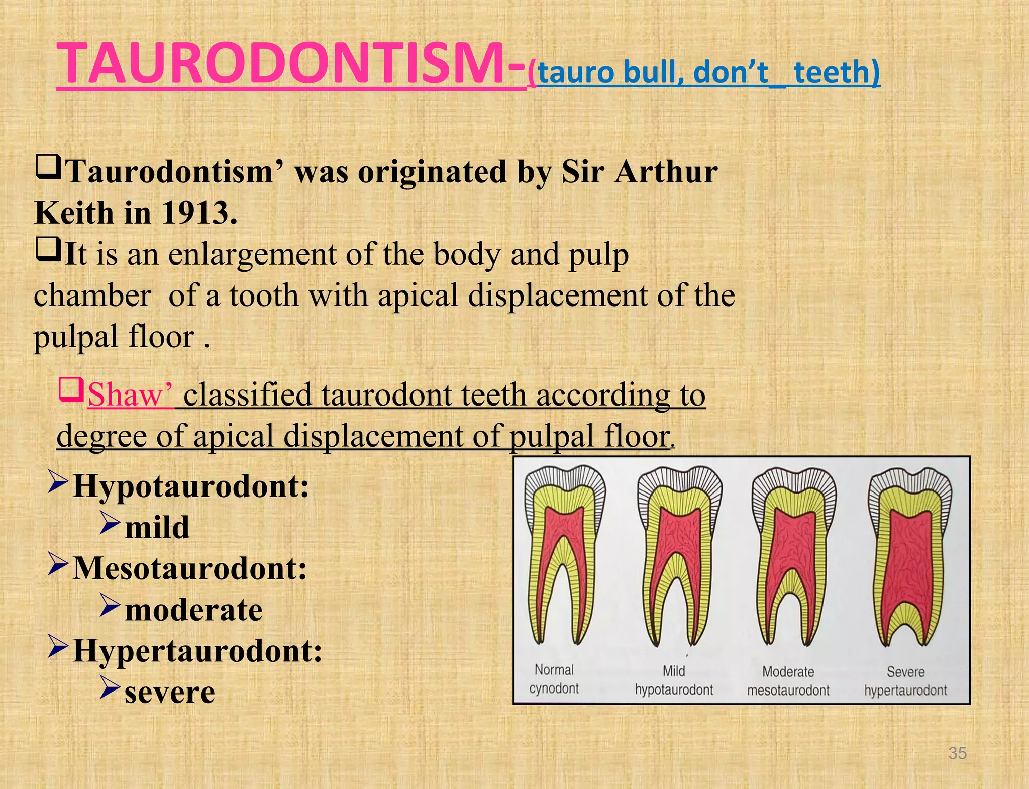 Developmental disturbances ofteeth sem | PPT