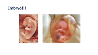 Development & Growth of Maxilla | PPTX