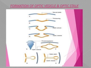 Developement of ocular structures | PPTX