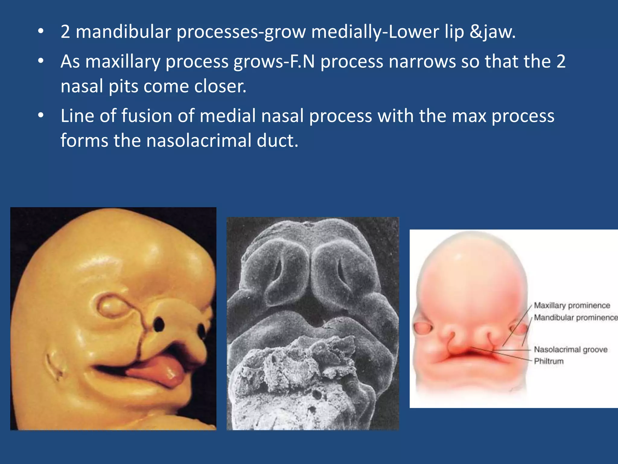 Developement of maxilla and mandible. | PPTX