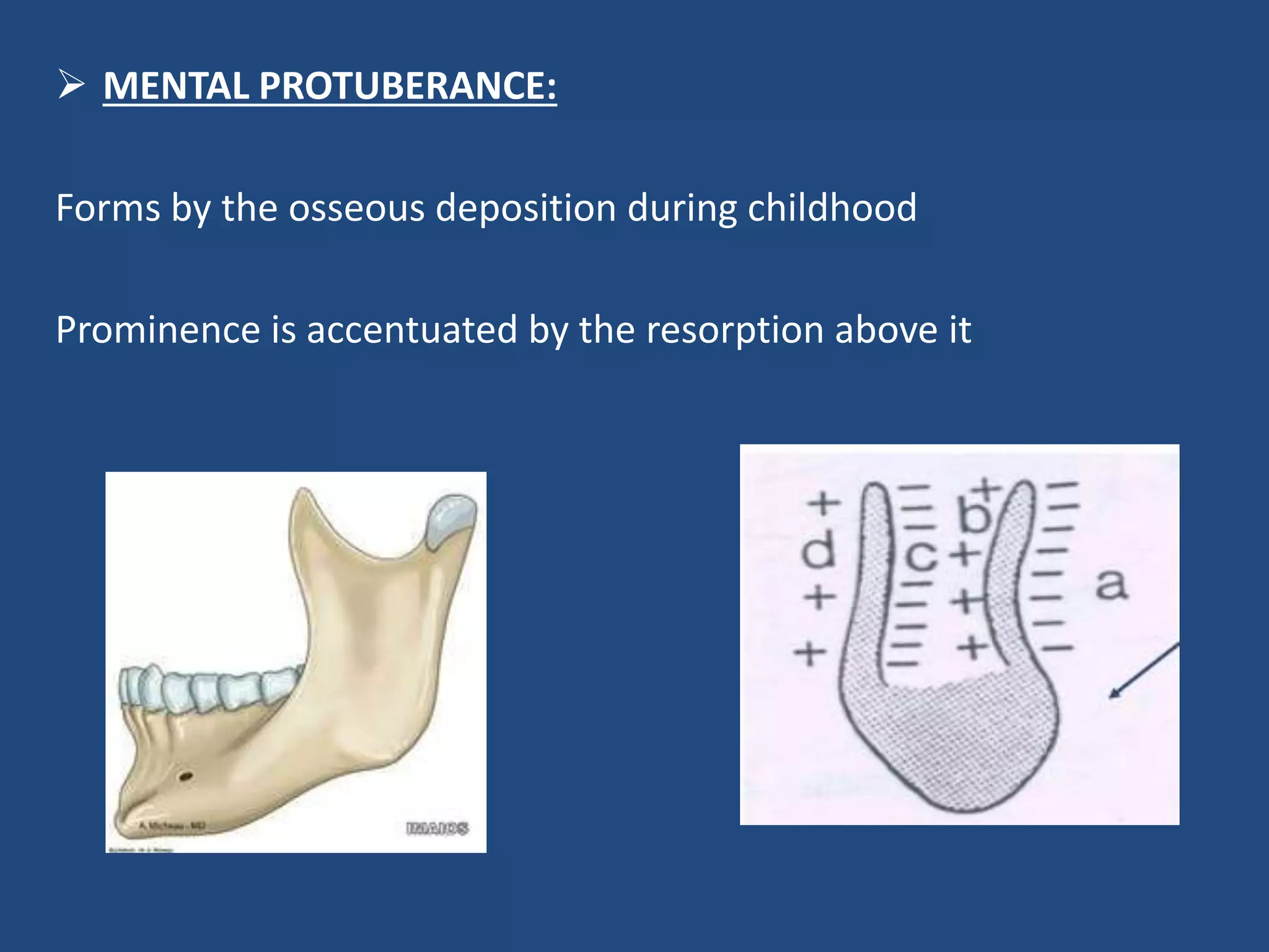 Developement of maxilla and mandible. | PPTX