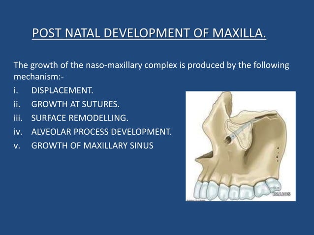 Developement of maxilla and mandible. | PPTX | Bone and Joint ...