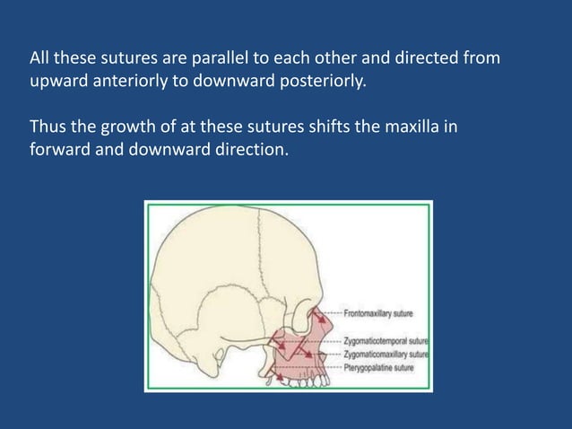Developement of maxilla and mandible. | PPTX | Bone and Joint ...
