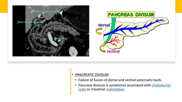 Development of liver, pancreas, spleen and extrahepatic biliary ...