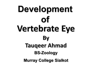 Development Of Eye by Tauqeer Ahmad | PPTX