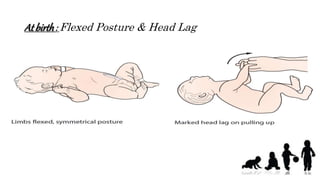Pediatric Developmental Assessment | PPTX