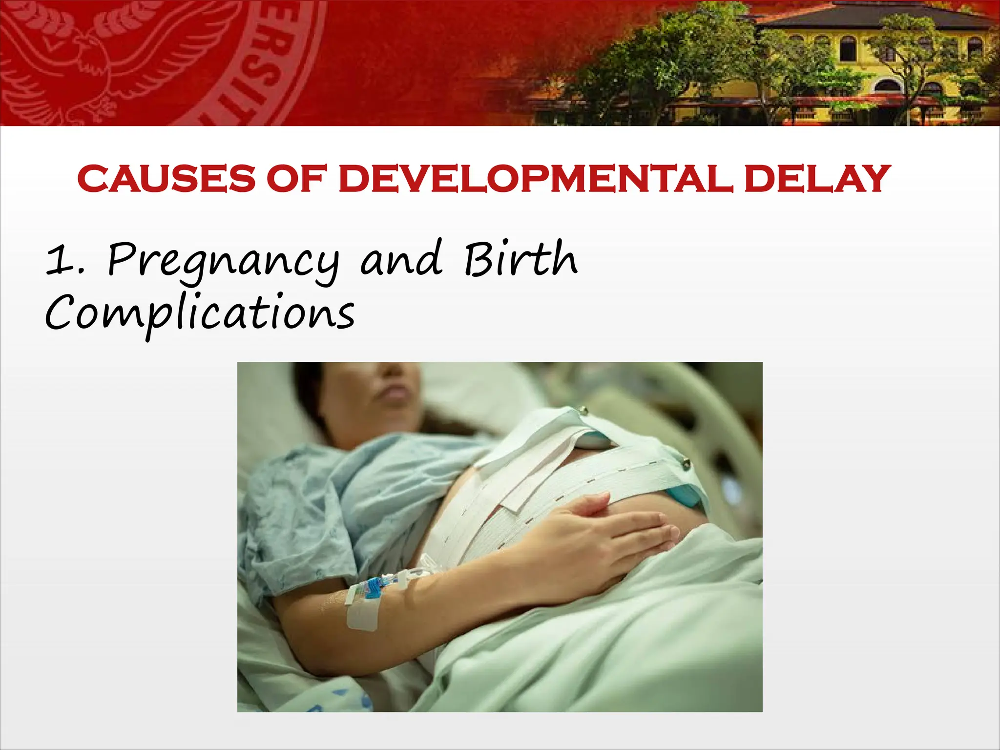 DEVELOPMENTAL-DELAY- in special education | PDF