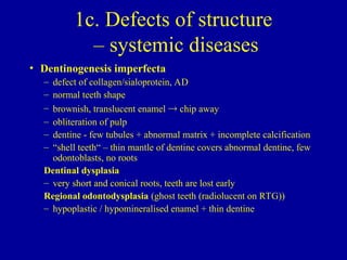 developmental-disorders in children’s teeth | PPT
