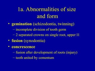 developmental-disorders in children’s teeth | PPT