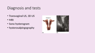 Developmental abnormalities of structures of female reproductive system ...