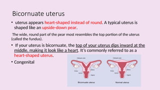 Developmental abnormalities of structures of female reproductive system ...