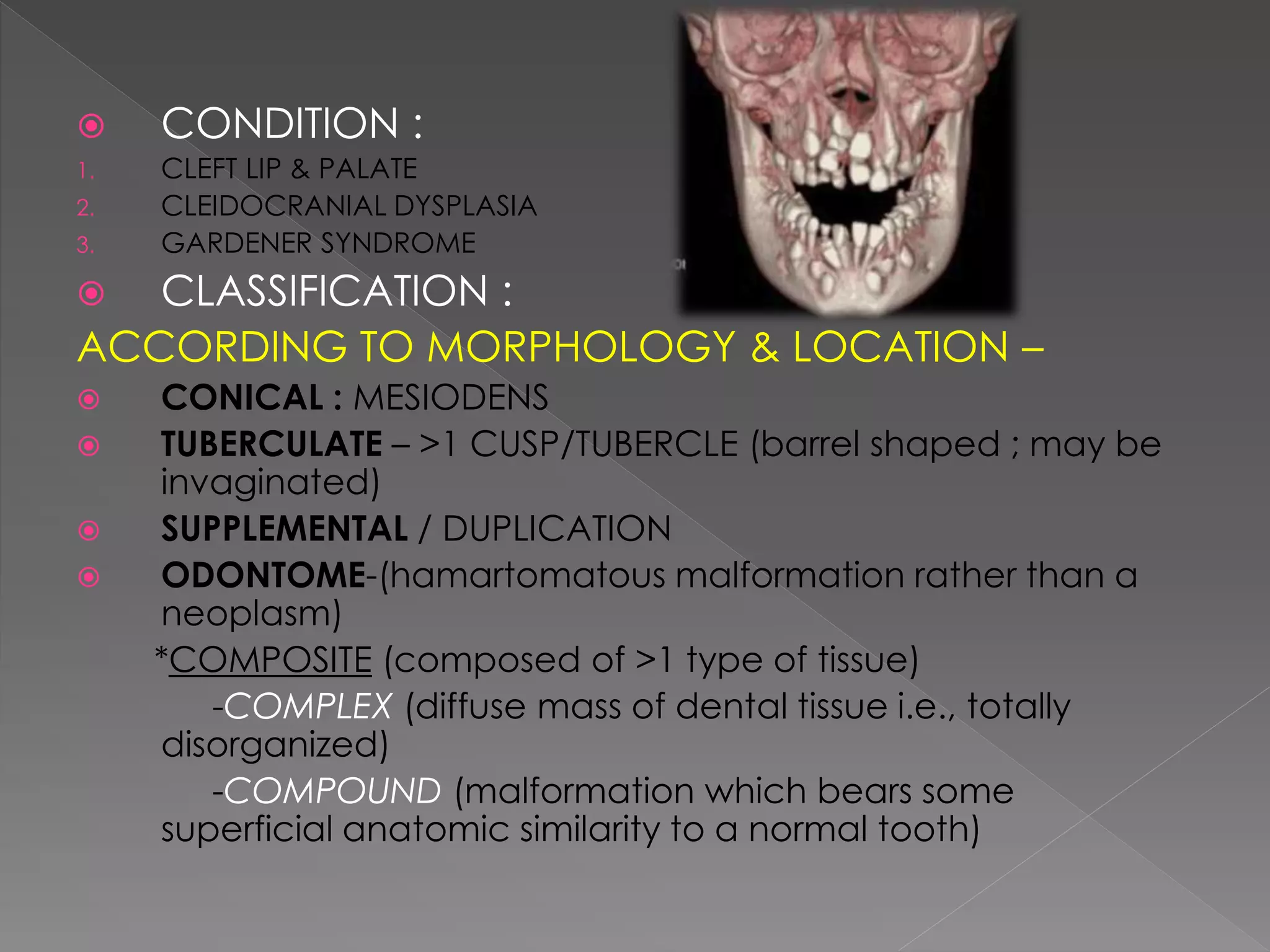 Developmental anomalies of teeth - by variyta | PPTX