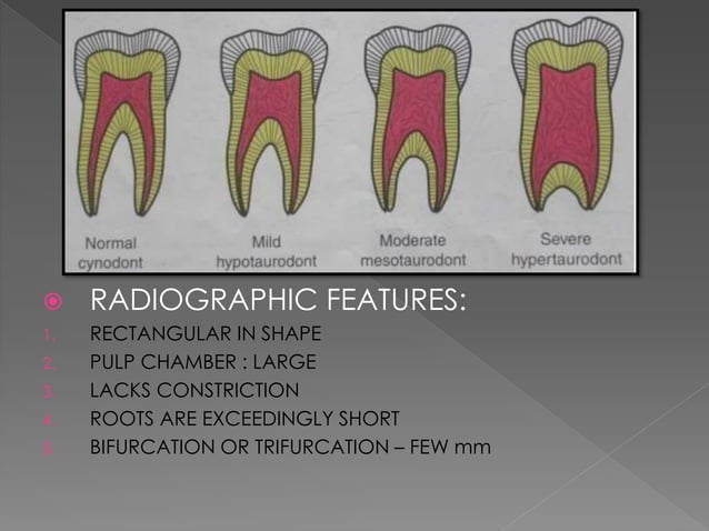 Developmental anomalies of teeth - by variyta | PPTX | Dental Health ...