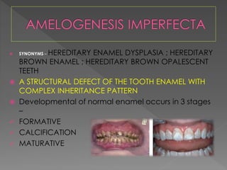 Developmental anomalies of teeth - by variyta | PPTX