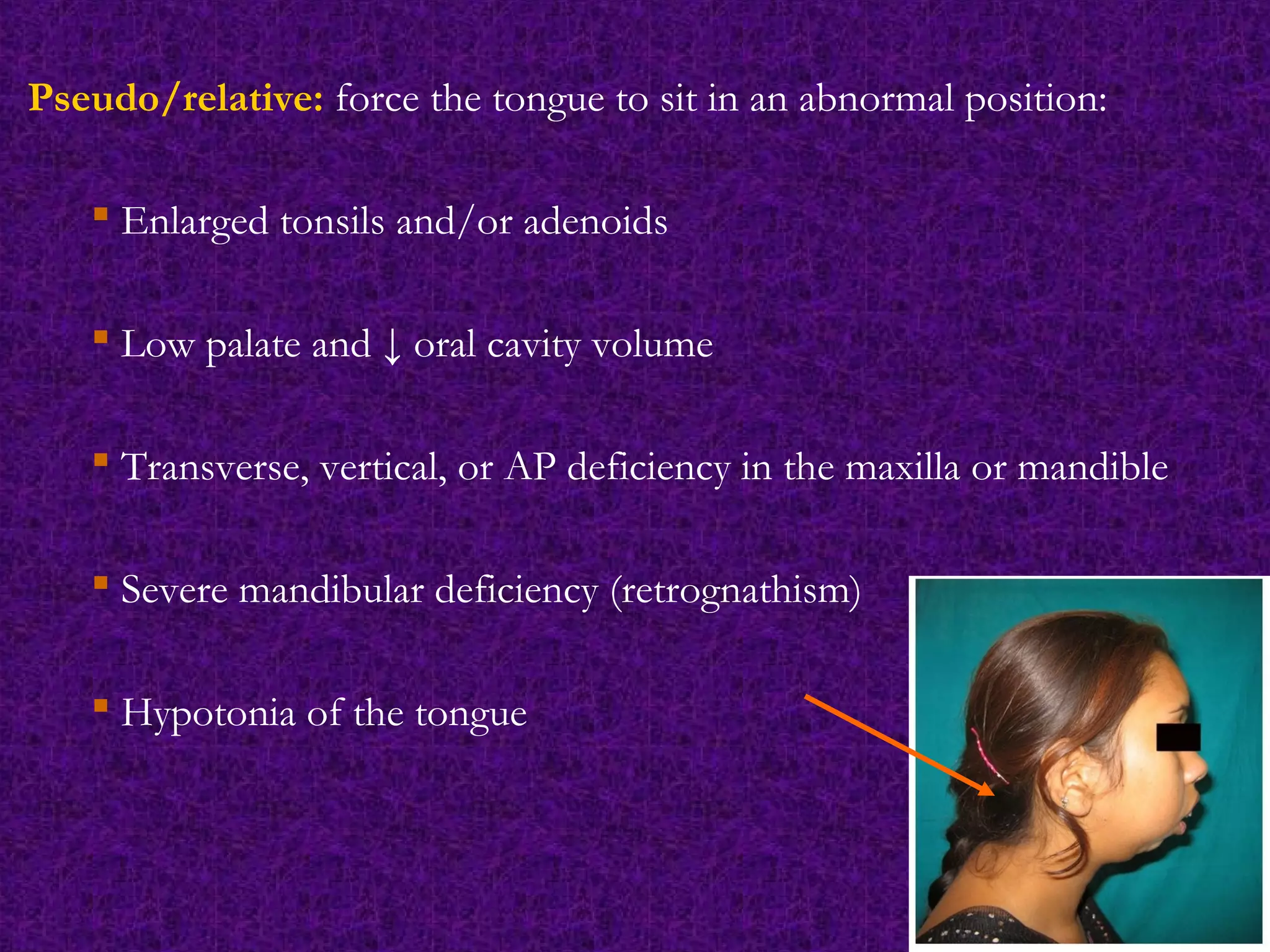 Oral Developmental anomalies | PPT