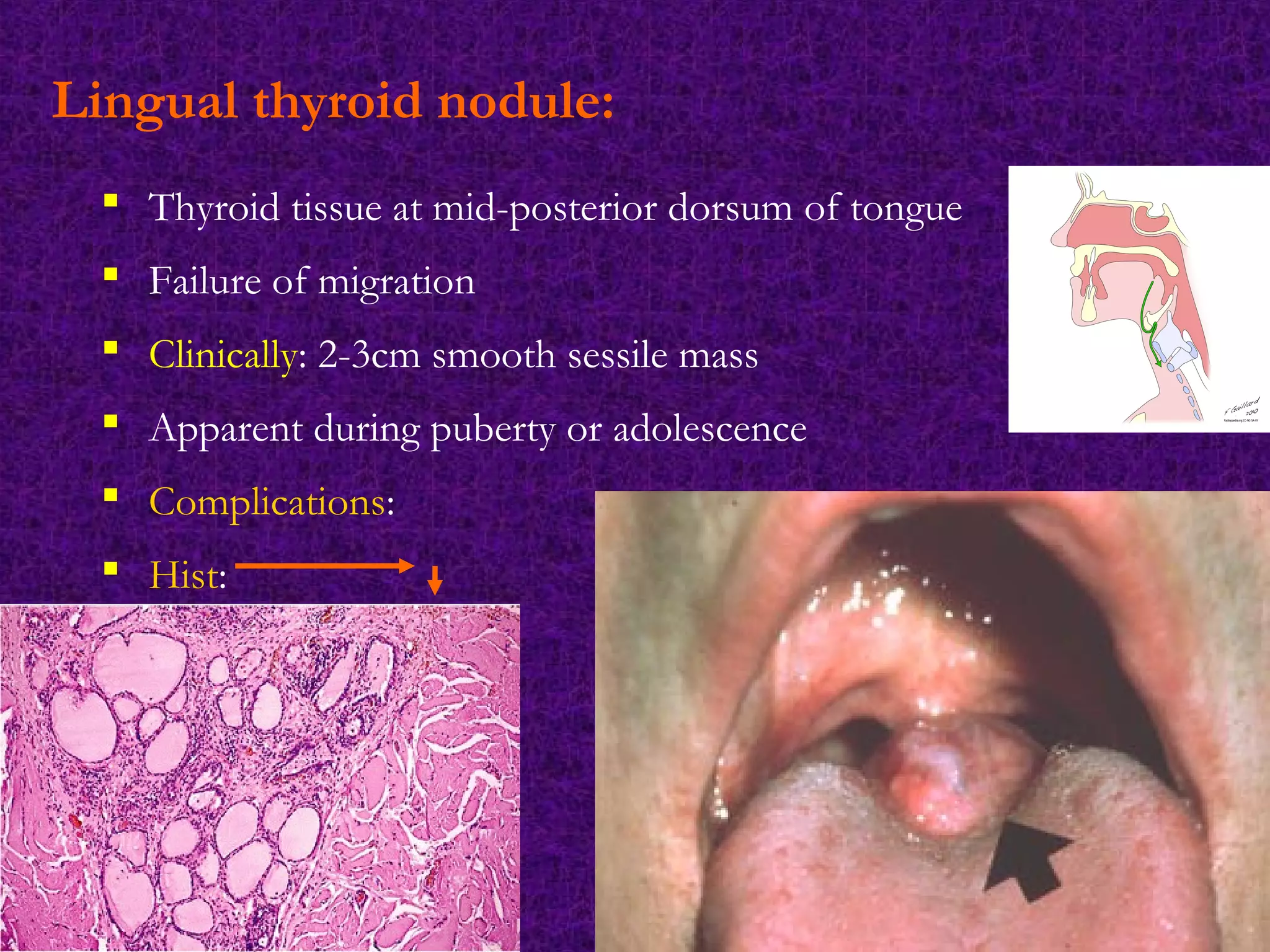 Oral Developmental anomalies | PPT