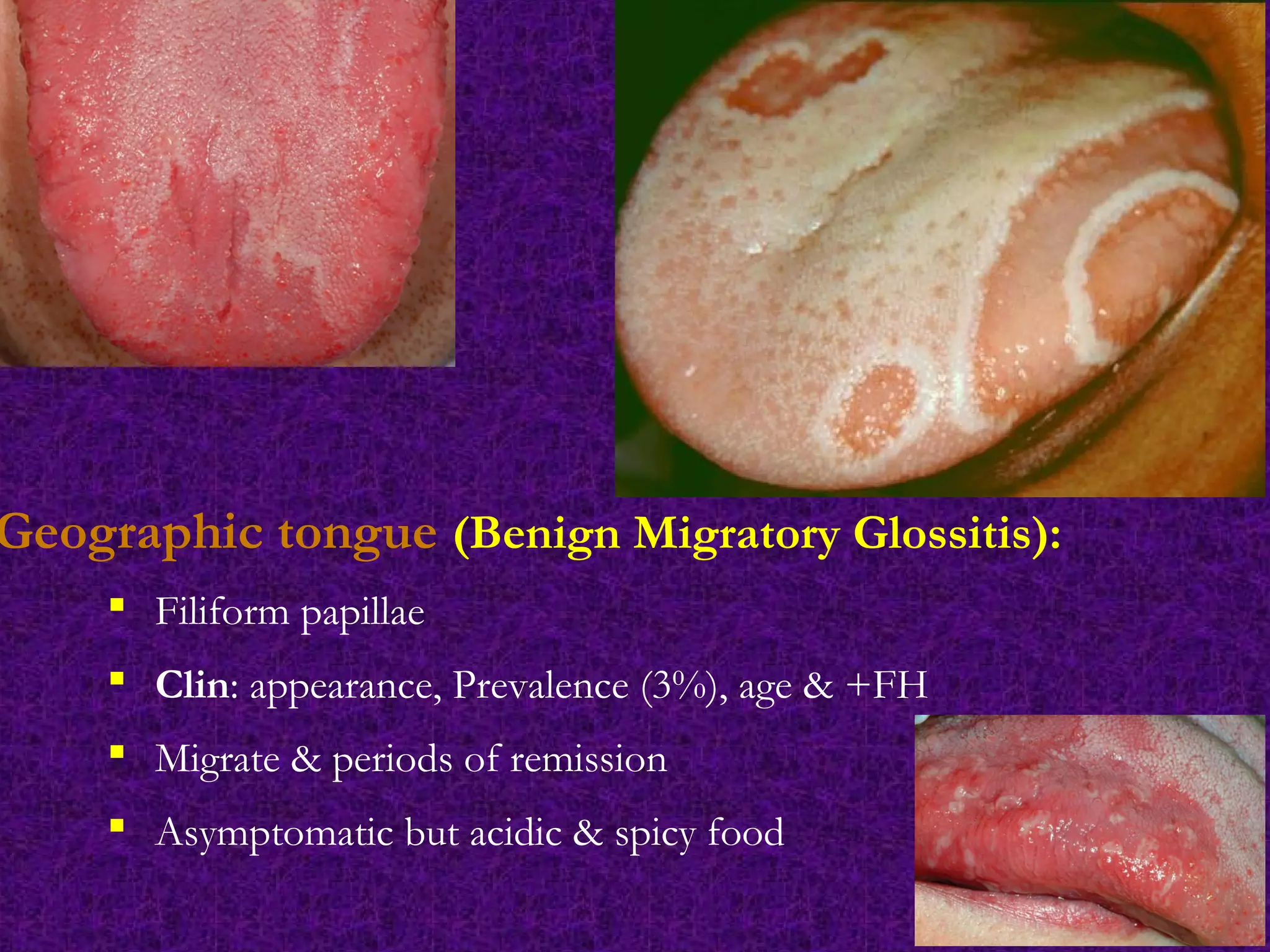 Oral Developmental anomalies | PPT