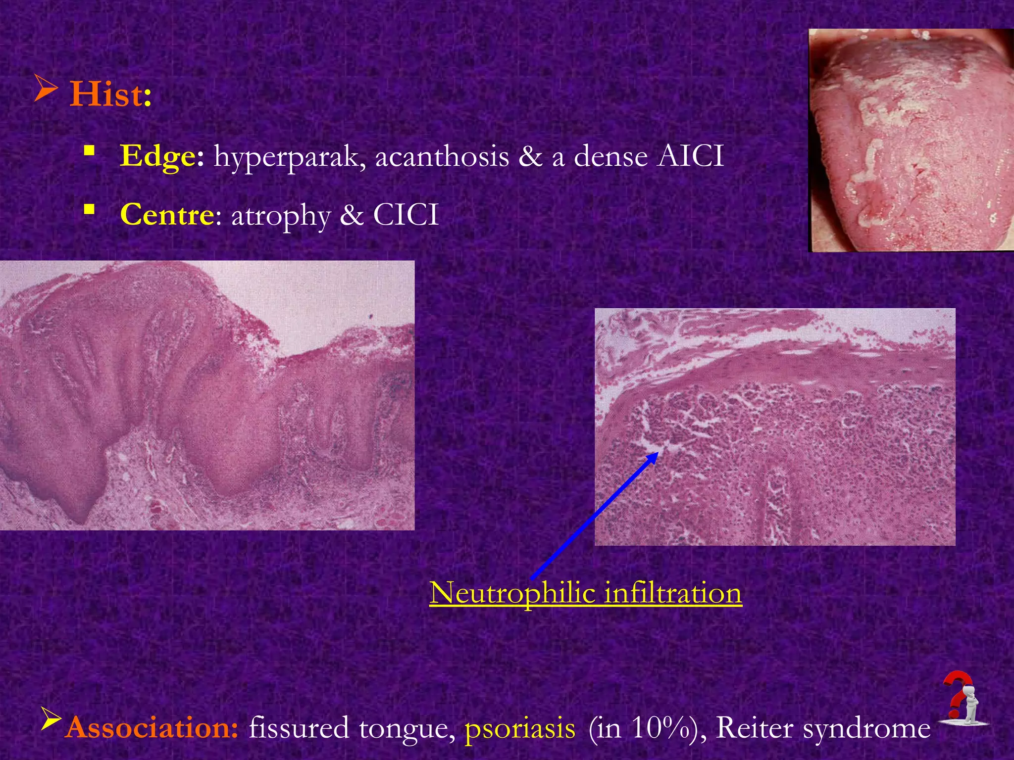 Oral Developmental anomalies | PPT