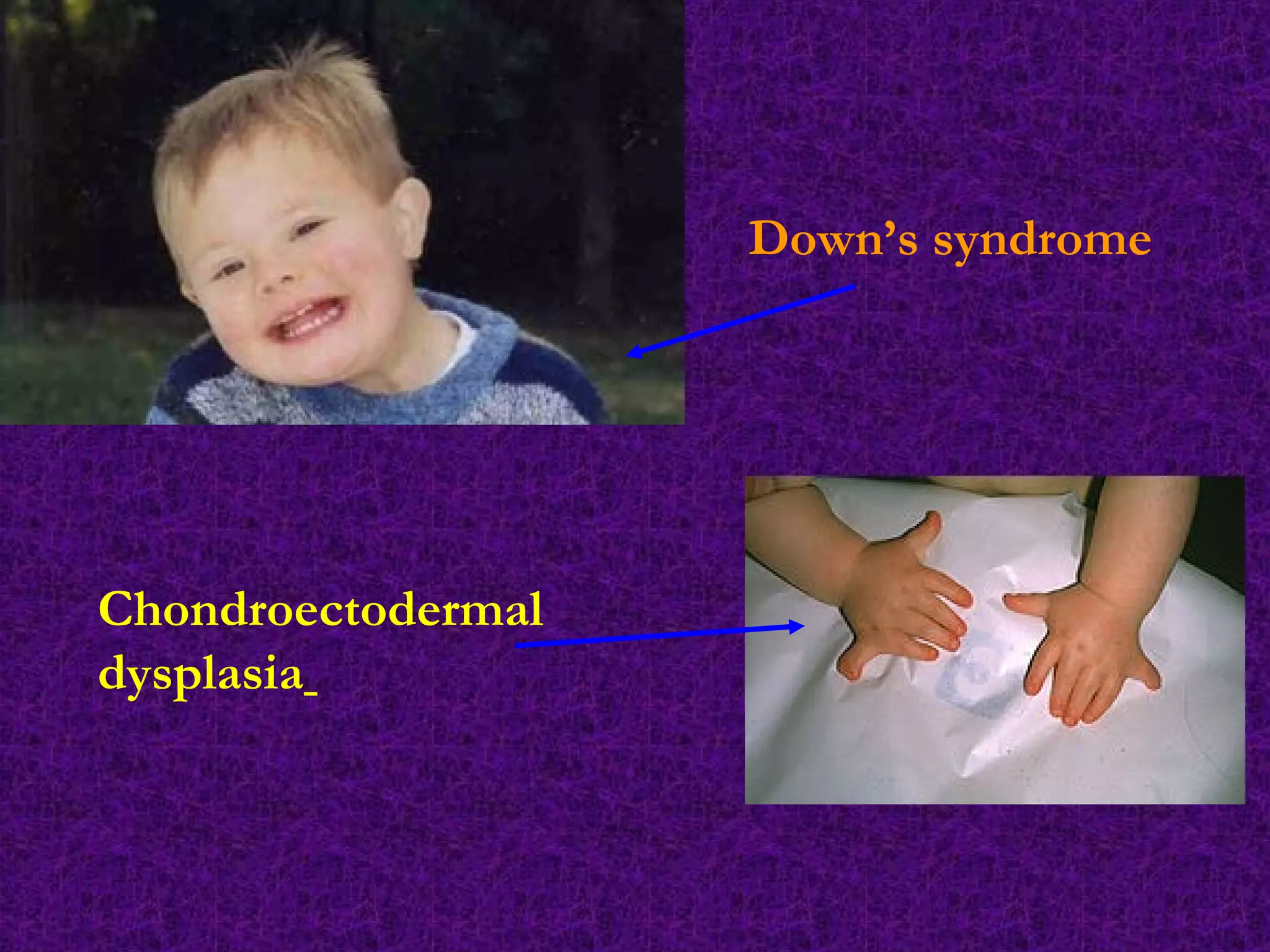 Oral Developmental anomalies | PPT