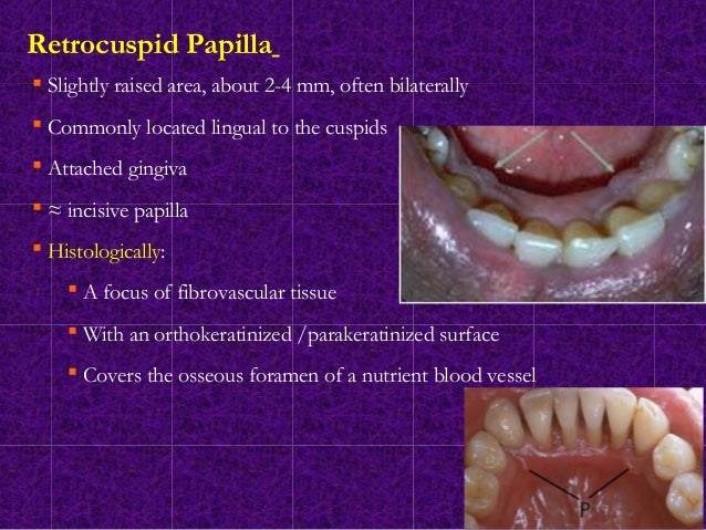 Oral Developmental anomalies