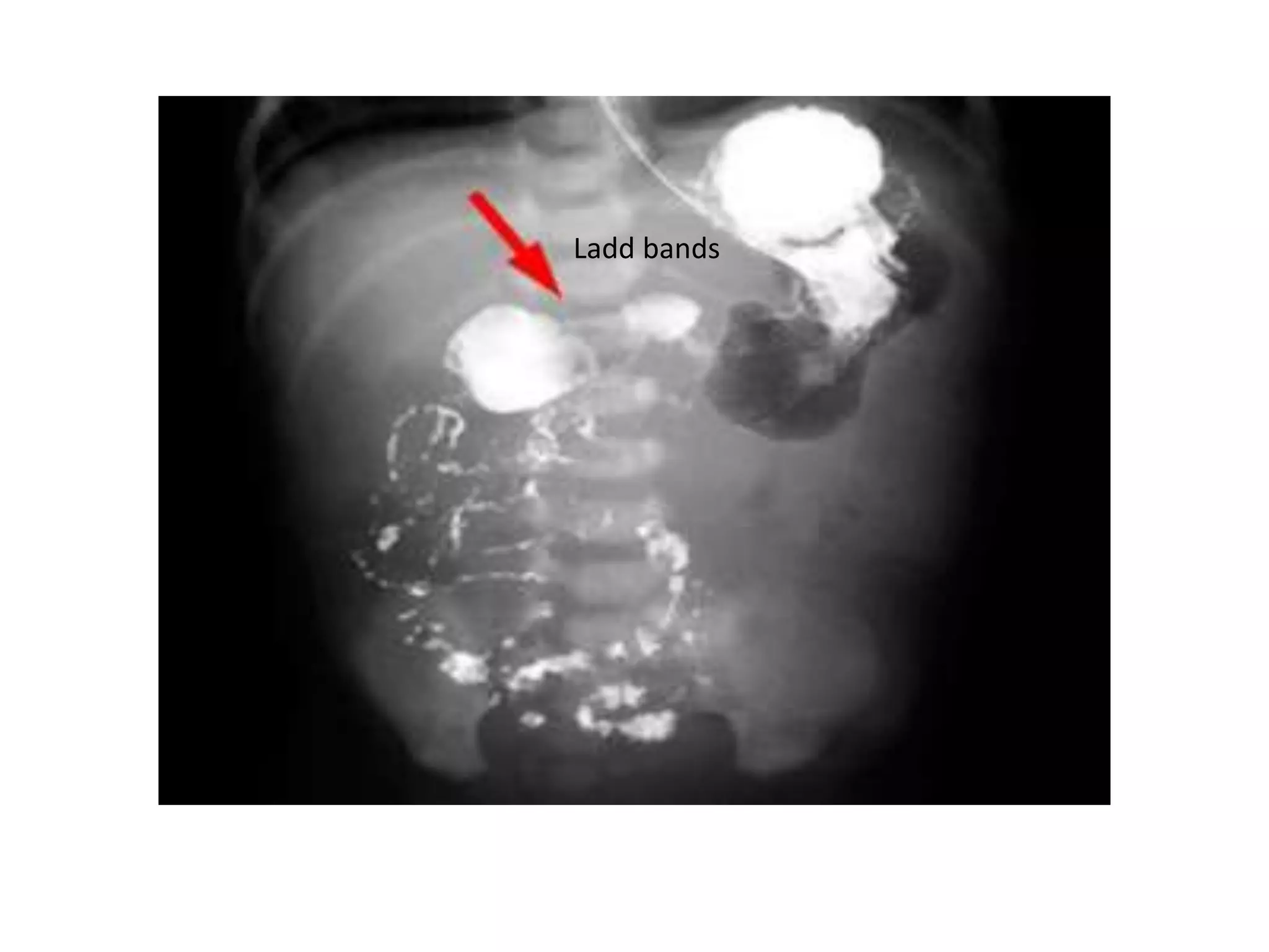 DEVELOPMENTAL ANOMALIES OF.pptx