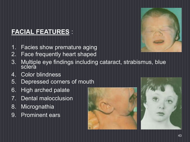 Developmental anomalies of craniofacial region | PPTX | Infertility ...