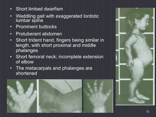 Developmental anomalies of craniofacial region | PPTX