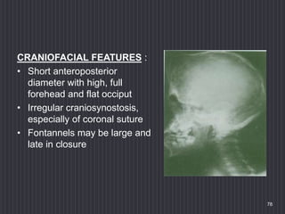 Developmental anomalies of craniofacial region | PPTX