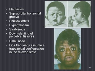 Developmental anomalies of craniofacial region | PPTX