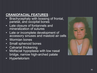 Developmental anomalies of craniofacial region | PPTX