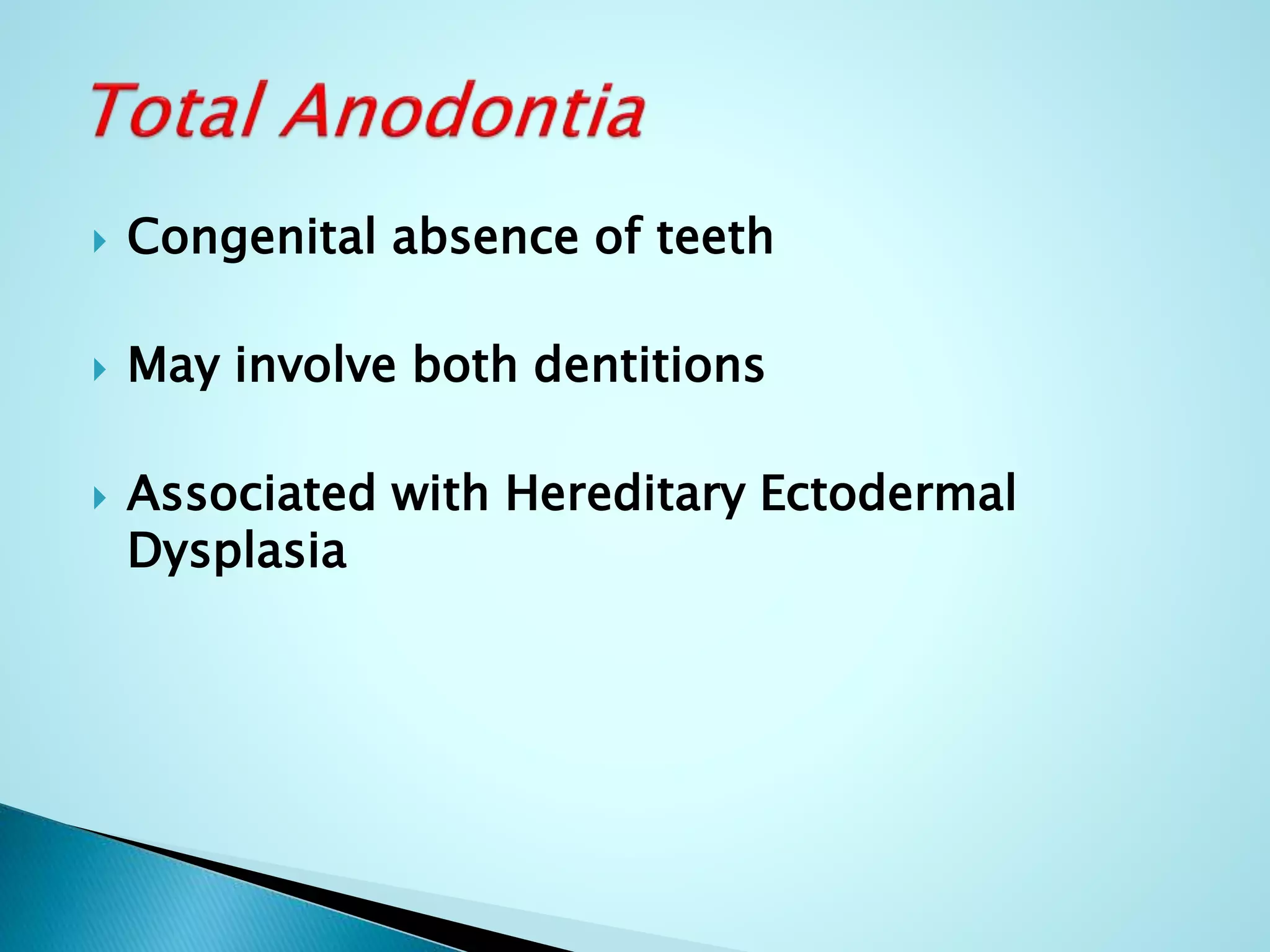 Developmental anomalies of teeth ,, | PPTX