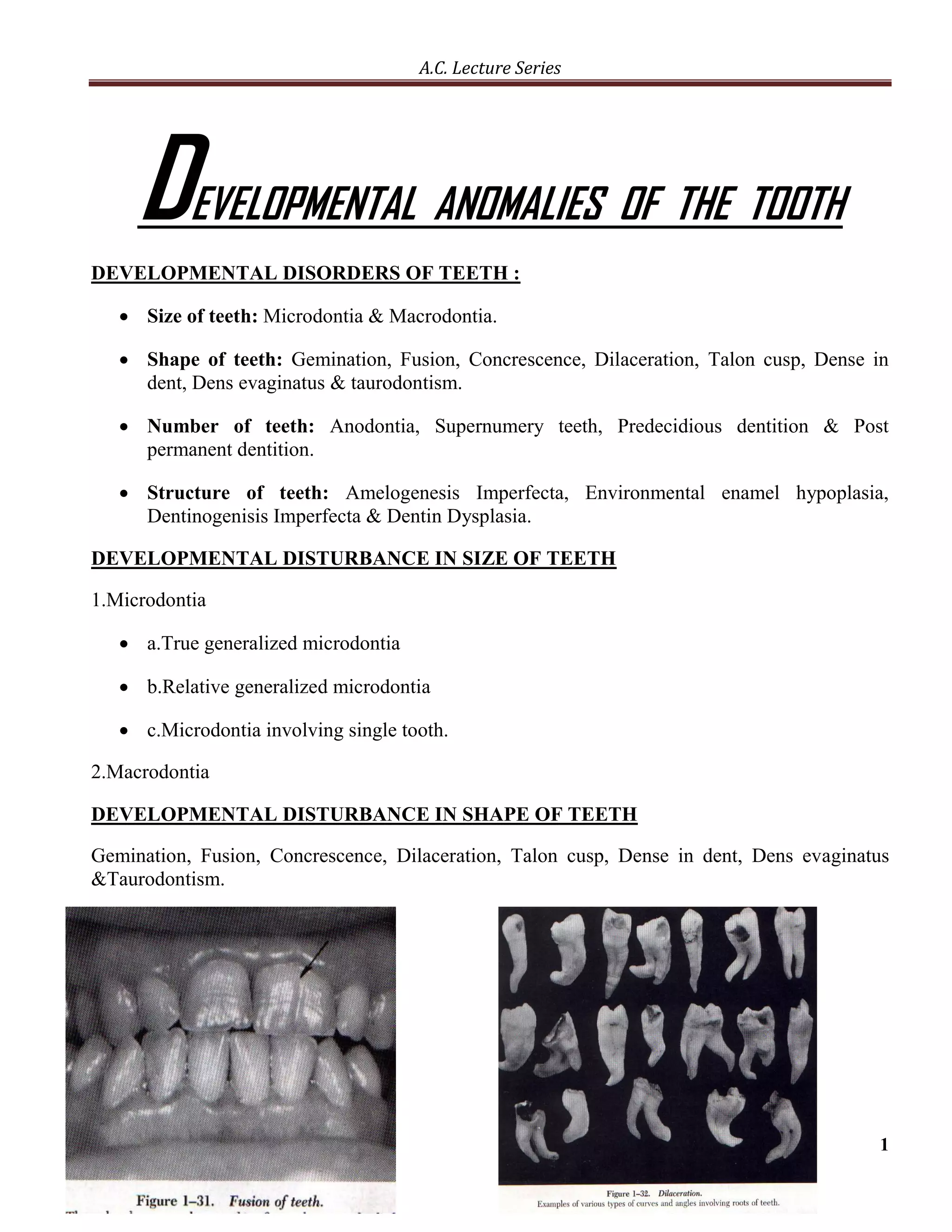 Developmental anomalies of the tooth | PDF