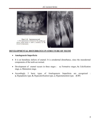 Developmental anomalies of the tooth | PDF