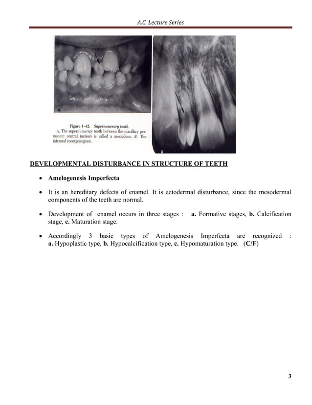 Developmental anomalies of the tooth | PDF