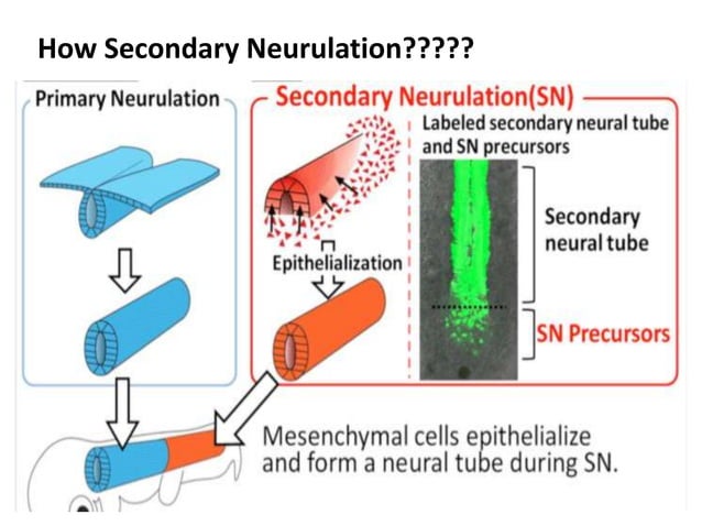 Neurulation | PPTX