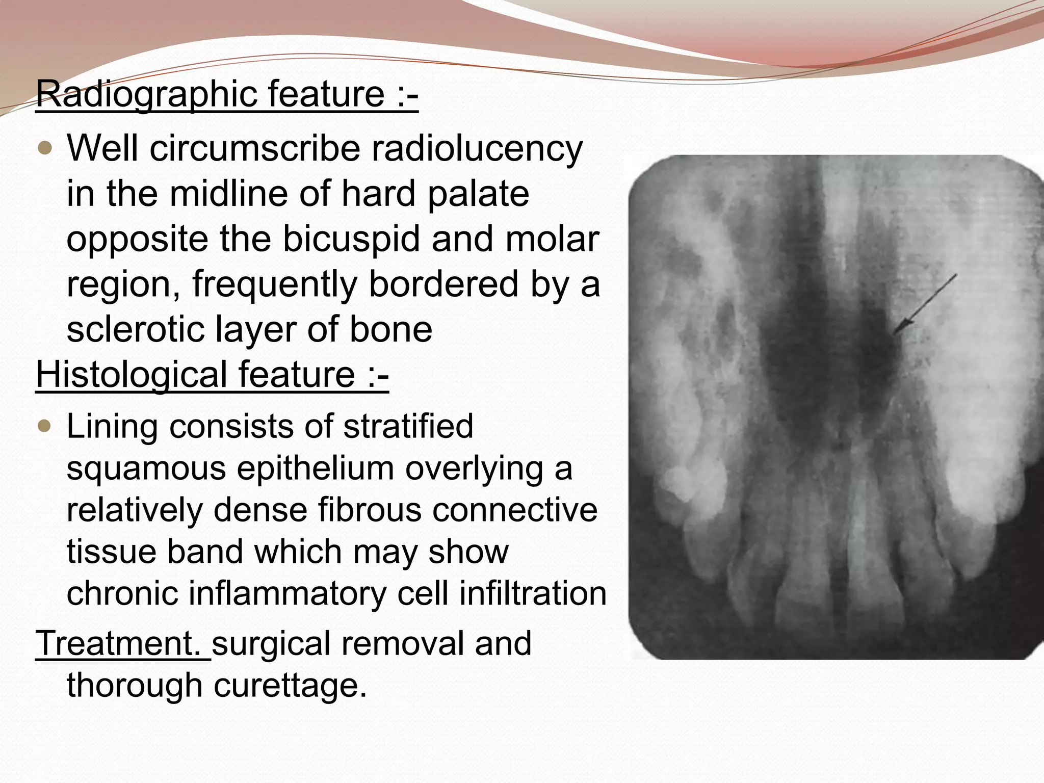 Developmental cysts.pptx