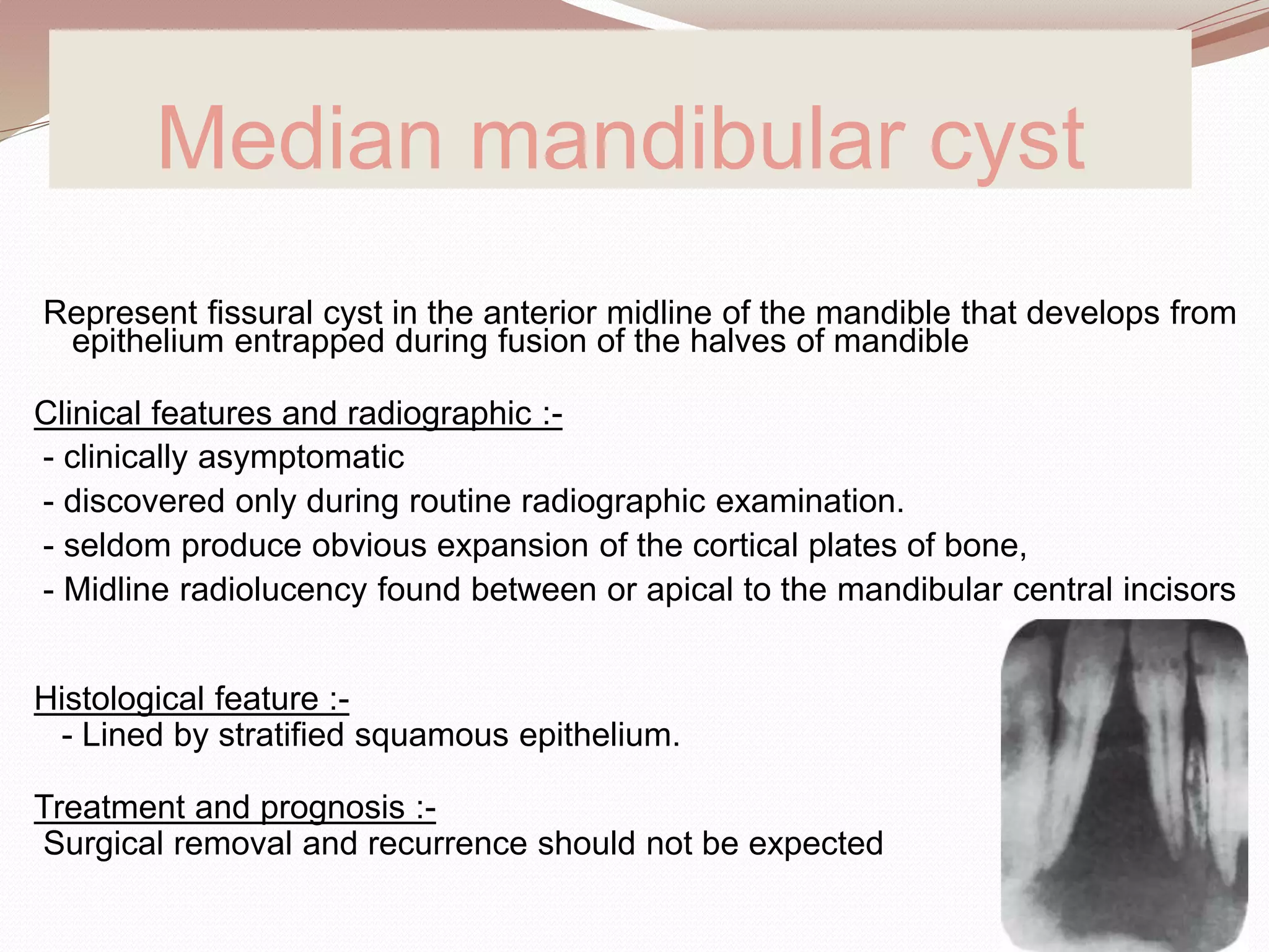 Developmental cysts.pptx