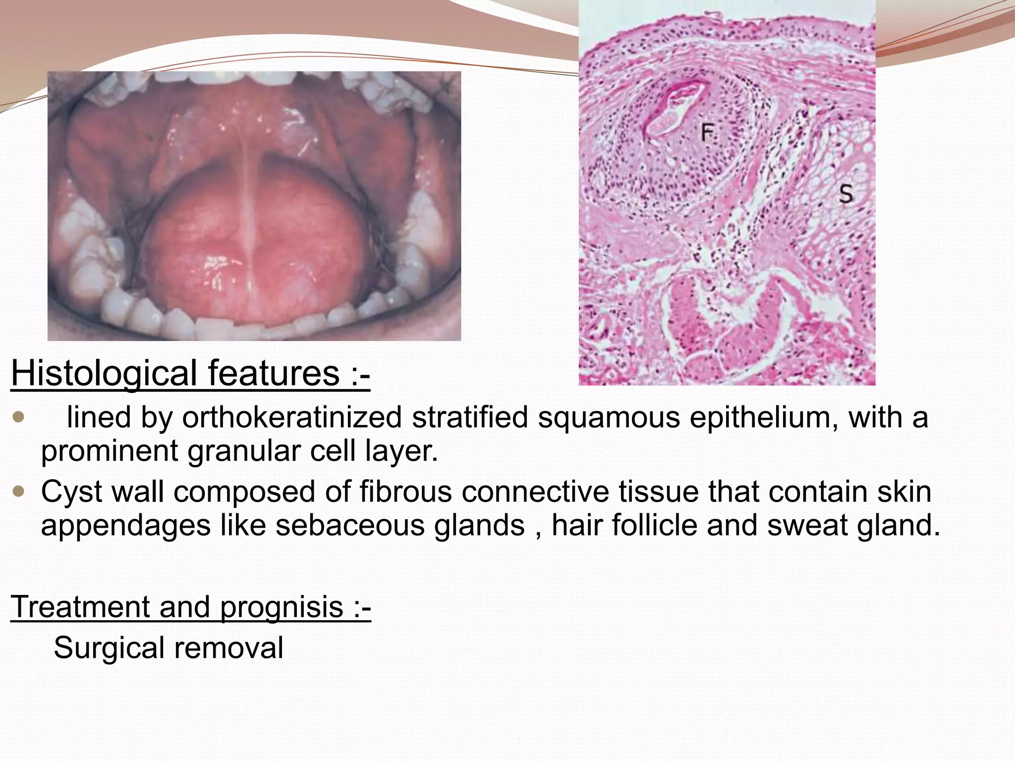 Developmental cysts.pptx